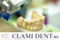 Implanturile Dentare și Alte Tratamente Restaurative