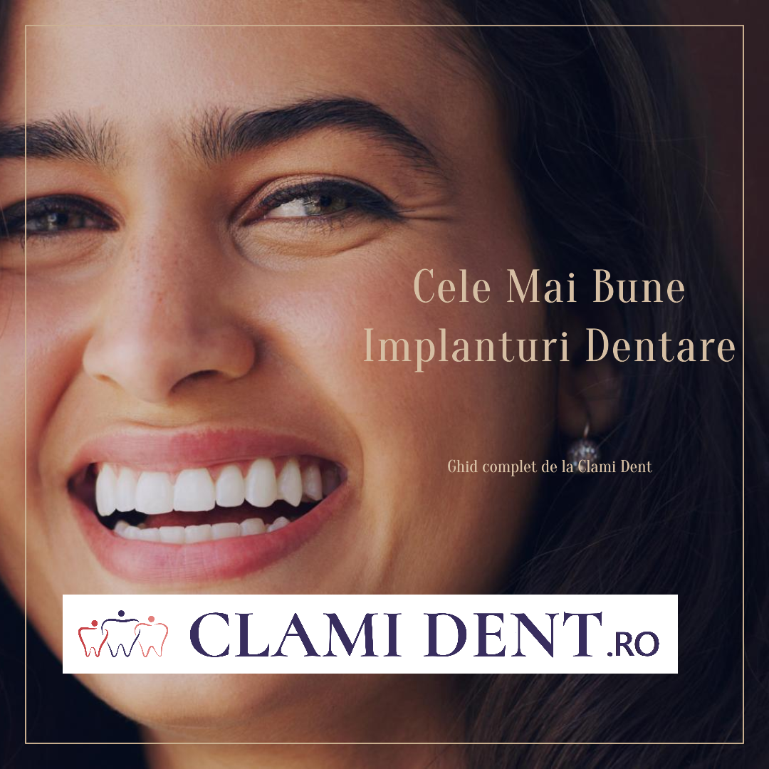 Care sunt cele mai bune implanturi dentare?