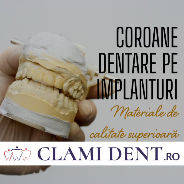 Alegerea materialului coroane dentare pe implanturi?