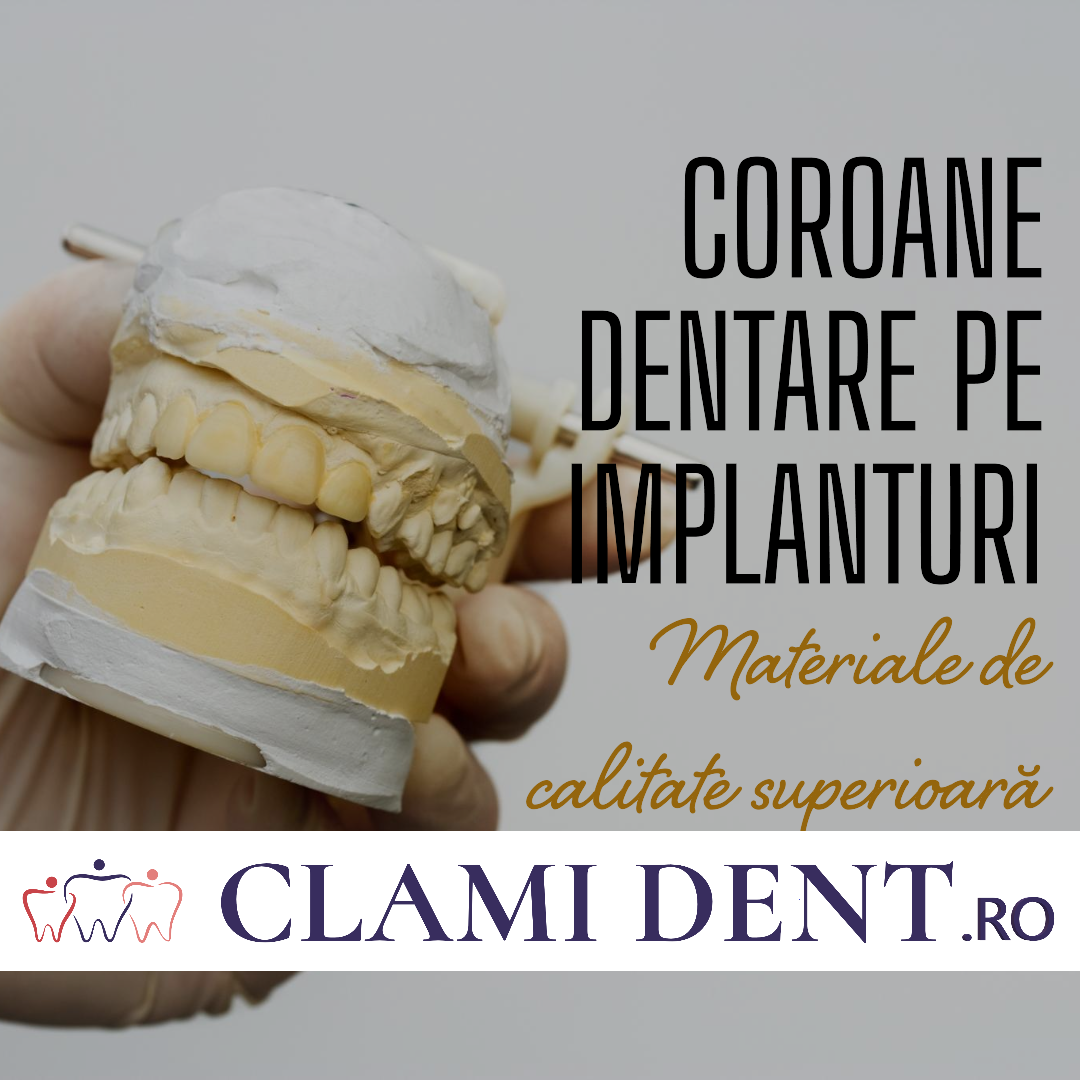 Alegerea materialului coroane dentare pe implanturi?